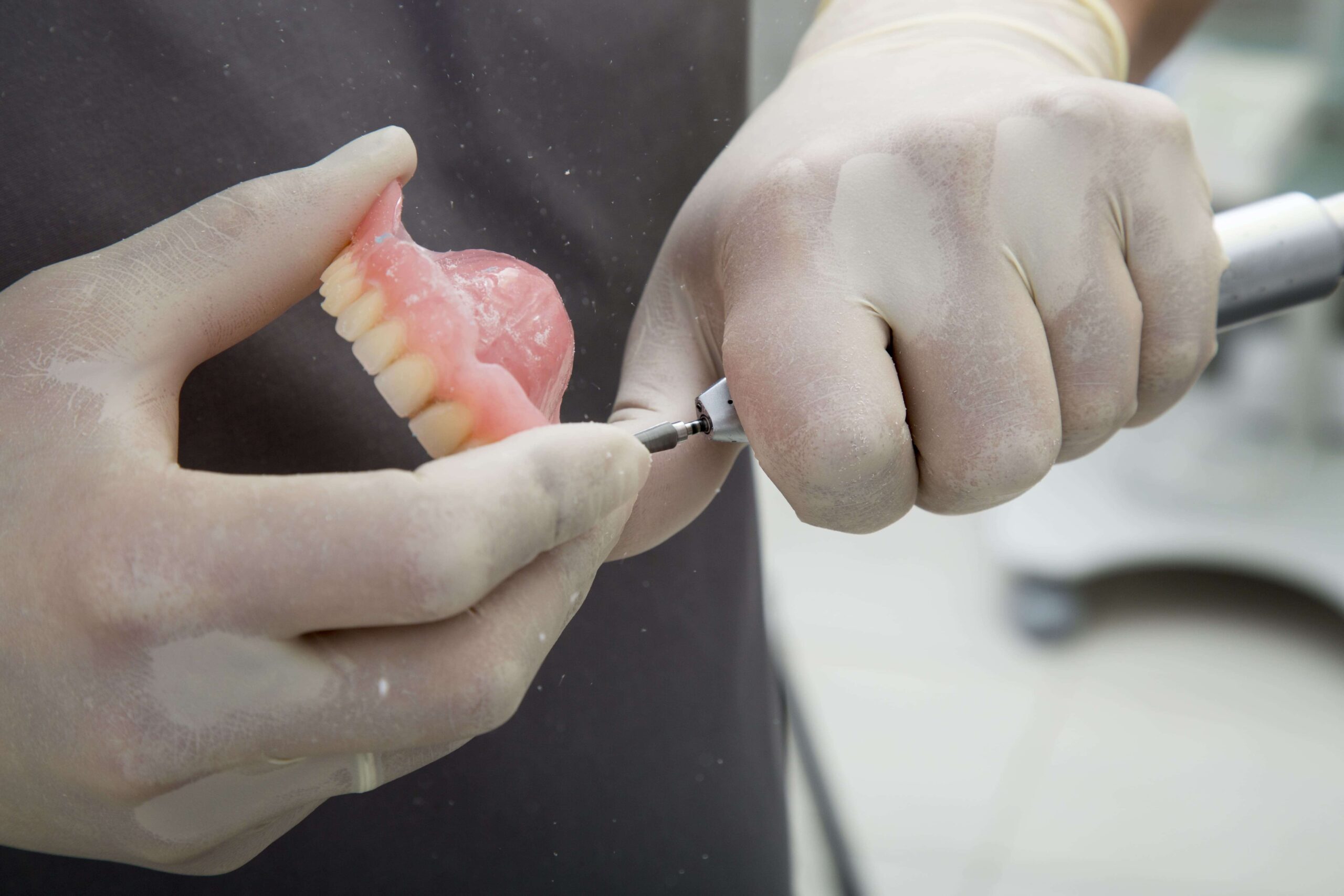 Denture Repairs & Relines in Adelaide | Emergency Repair Service